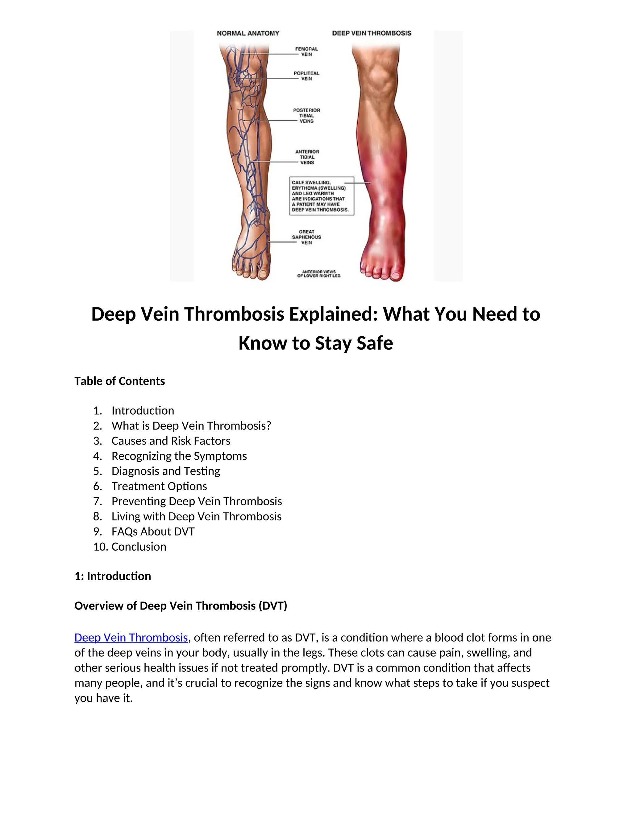Deep Vein Thrombosis Explained - What You Need to Know to Stay Safe.pdf