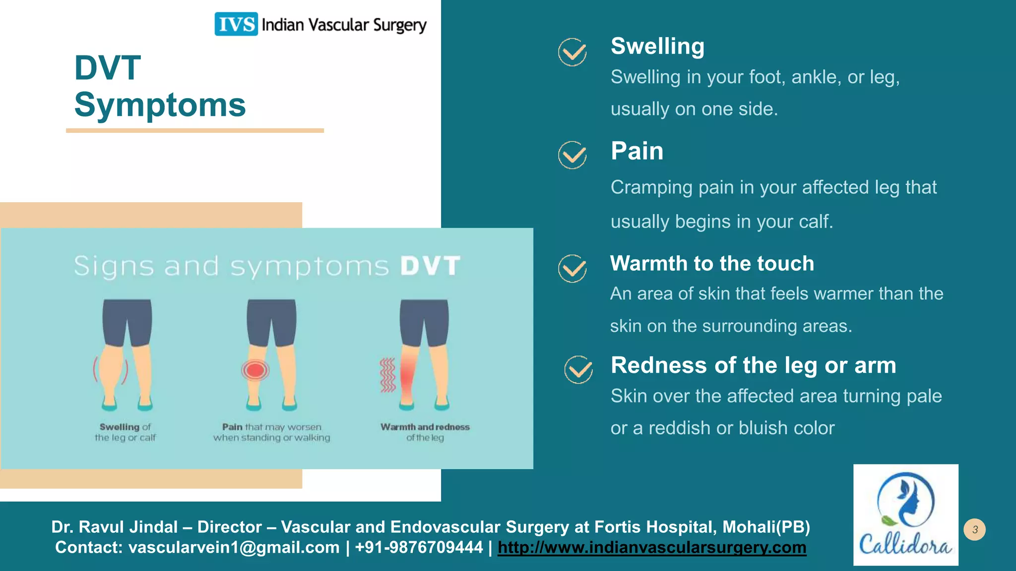 Deep Vein Thrombosis General Awareness | PPT