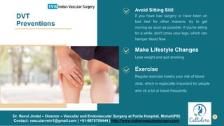 Deep Vein Thrombosis General Awareness | PPT