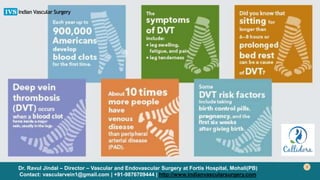 Deep Vein Thrombosis General Awareness | PPT