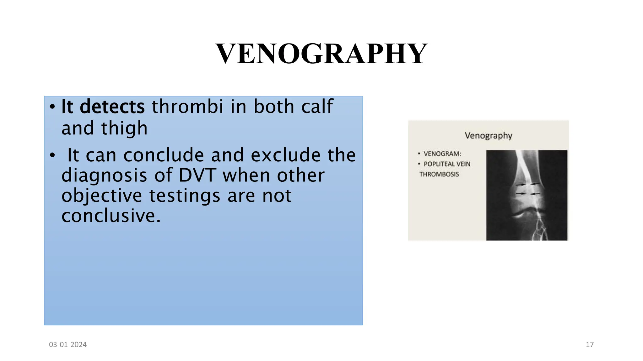 Deep Vein Thrombosis physiotherapy. pptx | PPTX