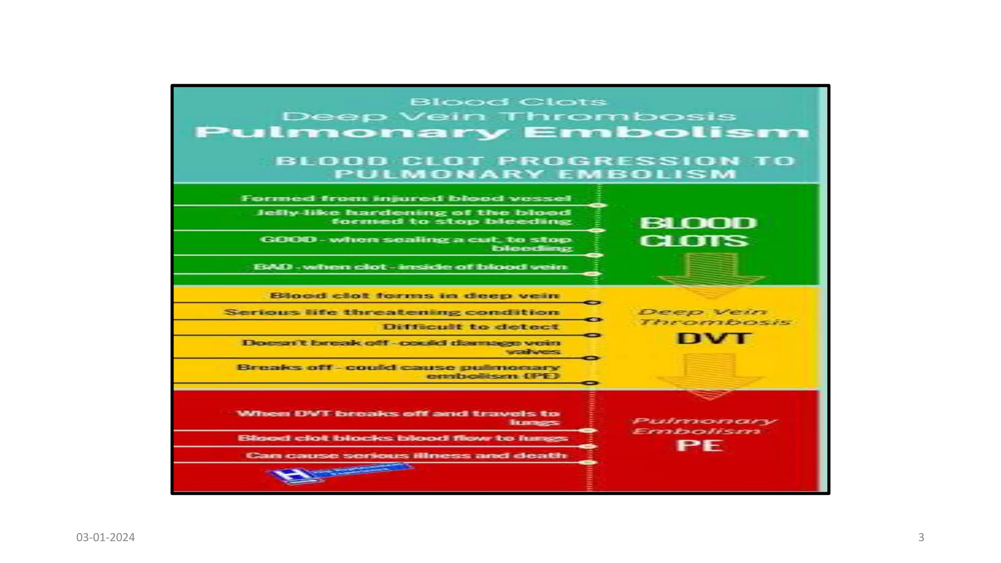 Deep Vein Thrombosis physiotherapy. pptx | PPTX