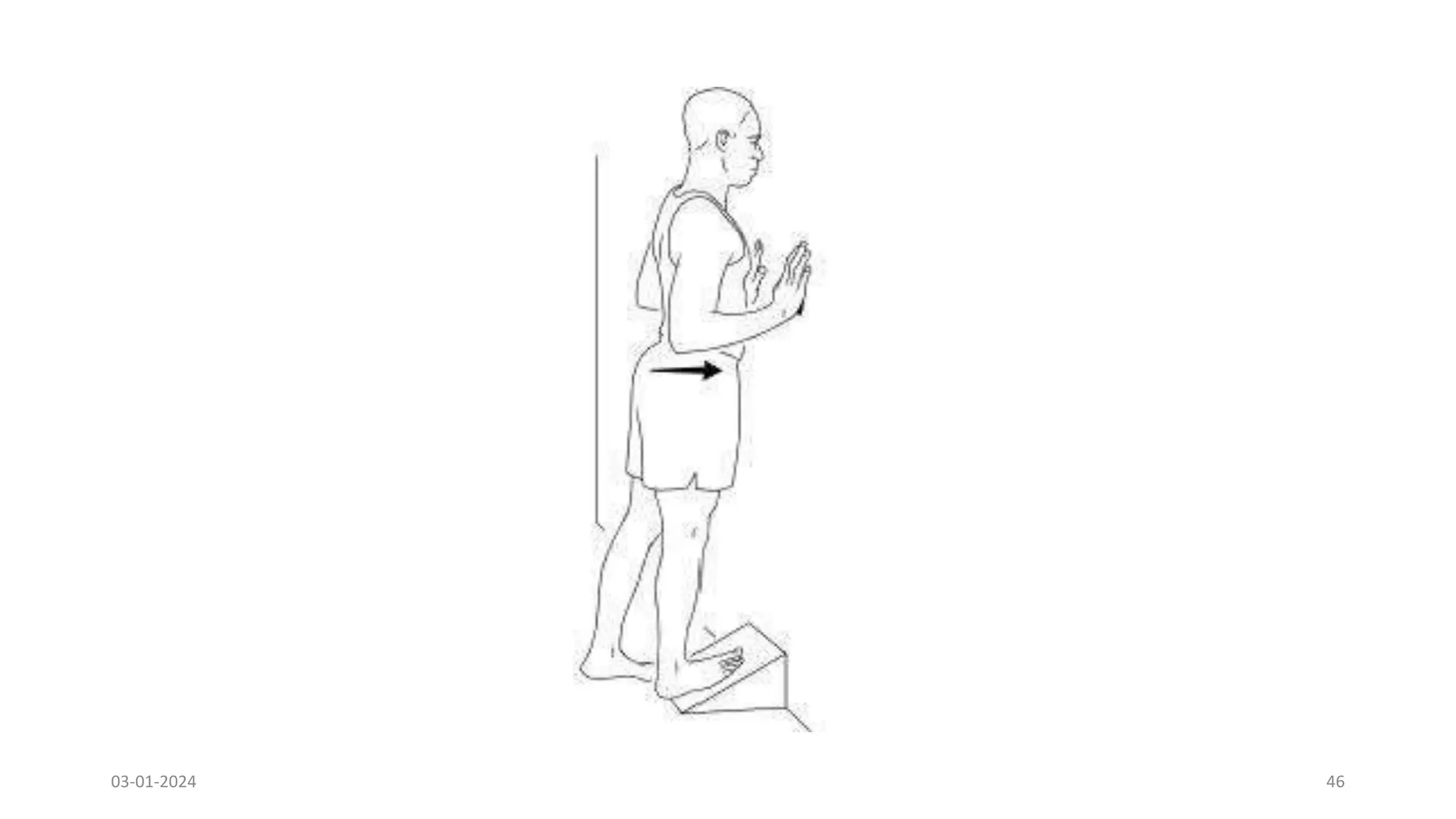 Deep Vein Thrombosis physiotherapy. pptx | PPTX
