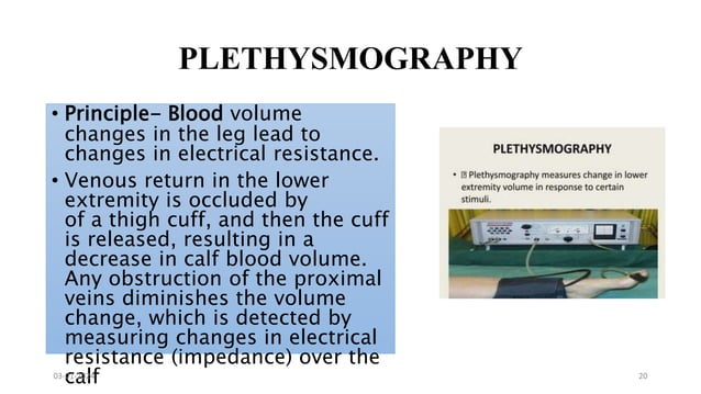 Deep Vein Thrombosis physiotherapy. pptx | PPTX