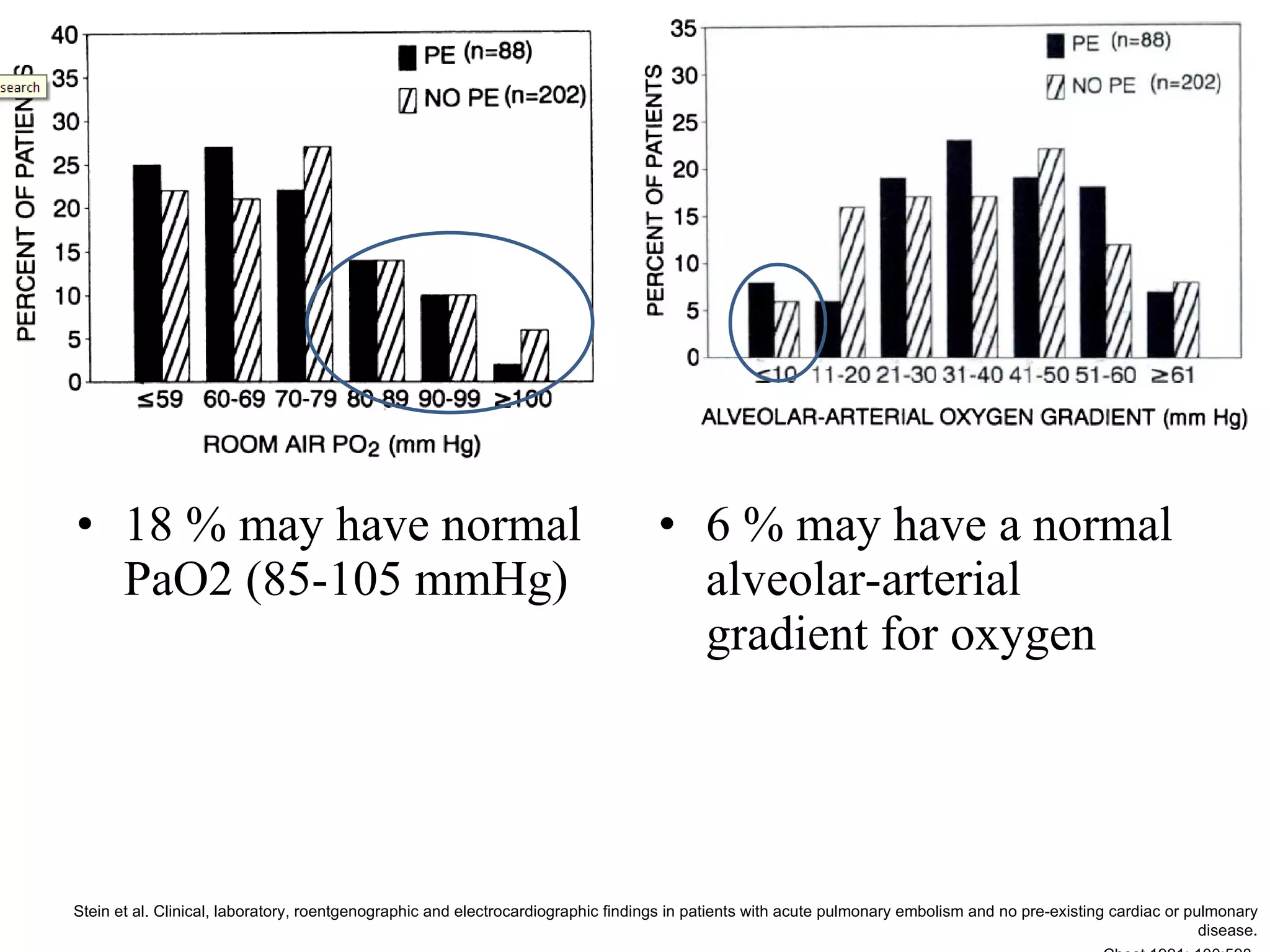 Deep Venous Thrombosis and Pulmonary Embolism : Diagnostic Approach and ...