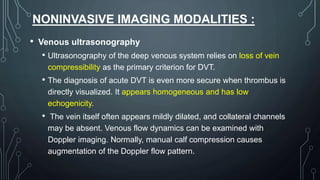 Deep vein thrombosis shivaom short | PPTX | Blood Disorders | Diseases ...