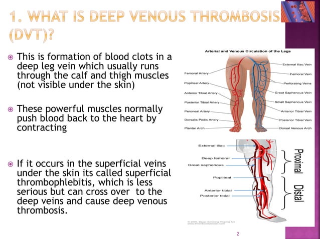 Deep venous thrombosis | PPT