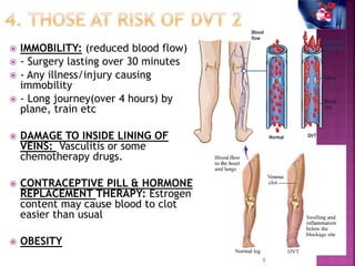 Deep venous thrombosis | PPT