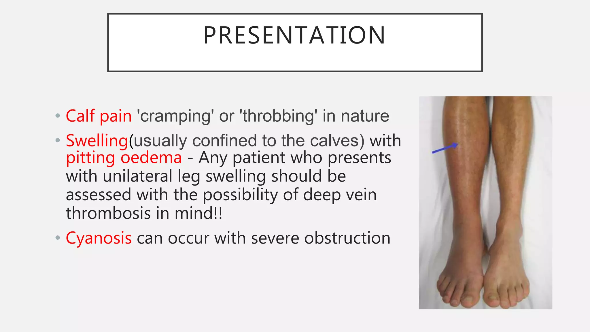 Deep venous thrombosis | PPTX