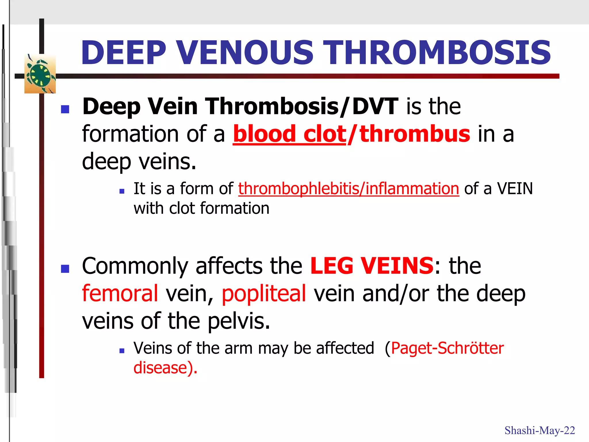 DEEP VENOUS THROMBOSIS (2).ppt