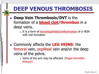 DEEP VENOUS THROMBOSIS (2).ppt