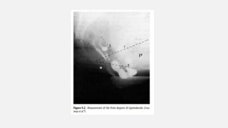 DEFECOGRAPHY.pptx