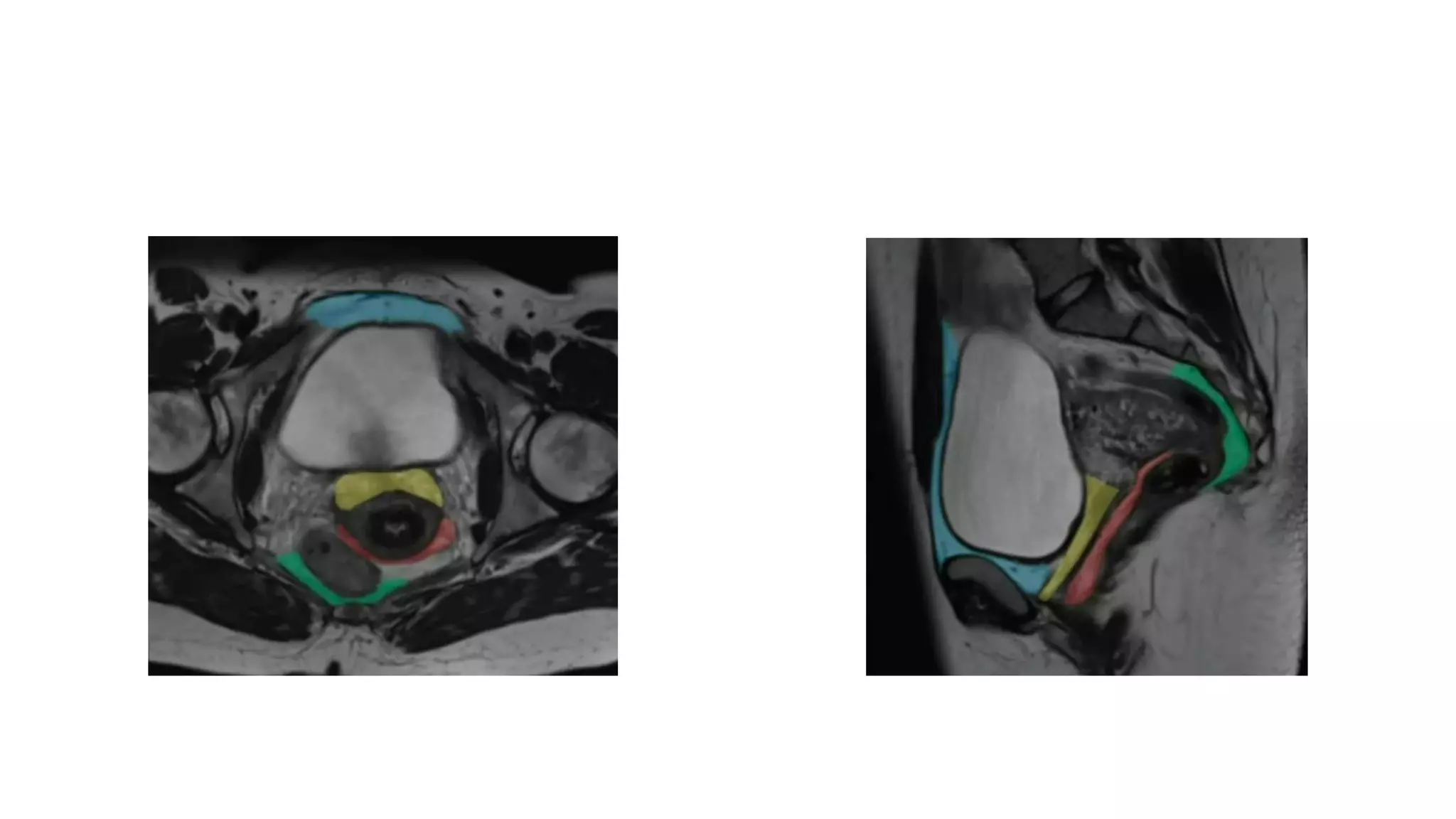 Defecography (1).pptx