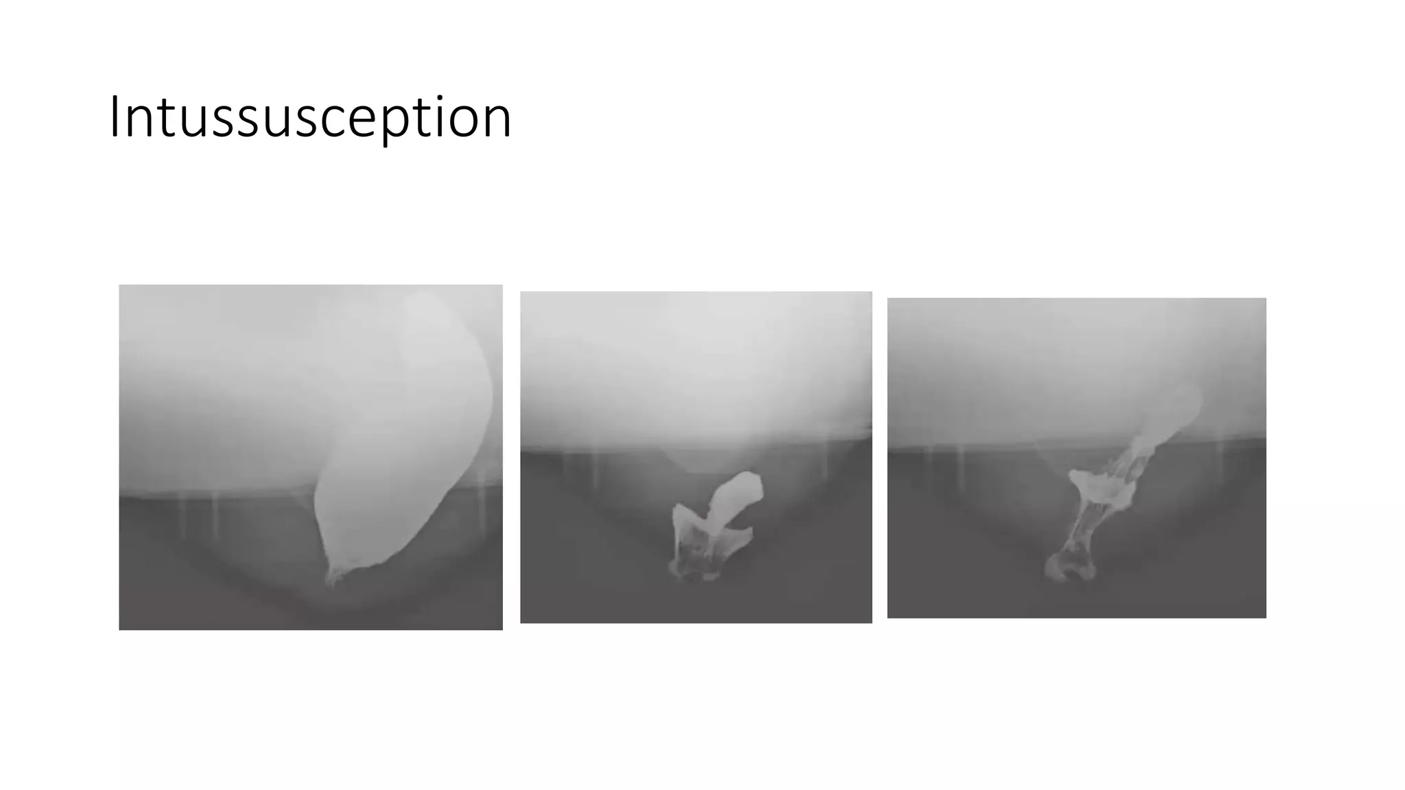 Defecography (1).pptx