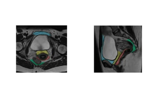 Defecography (1).pptx