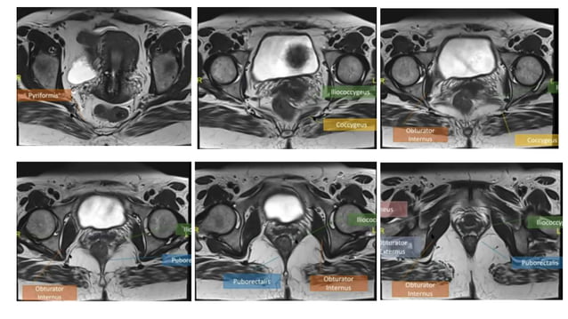 Defecography (1).pptx | Digestive Disorders | Diseases and Conditions