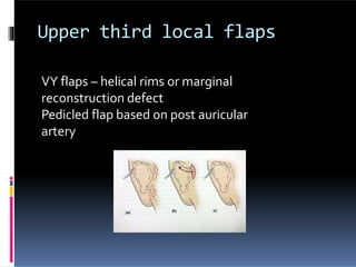 defectbasedreconstruction-160619105654.pptx