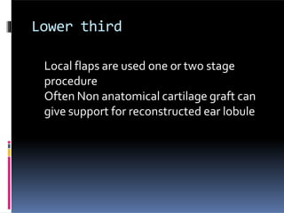 defectbasedreconstruction-160619105654.pptx