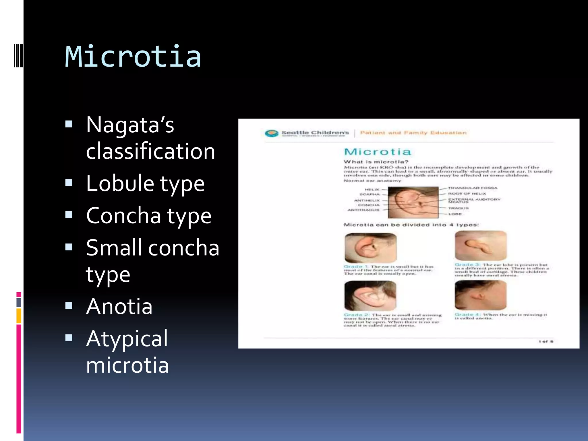 Defect based reconstruction of ear | PPTX