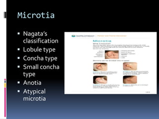 Defect based reconstruction of ear | PPTX