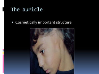 Defect based reconstruction of ear | PPTX