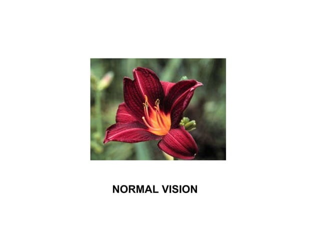 Defective Colour Vision 1 | PPT