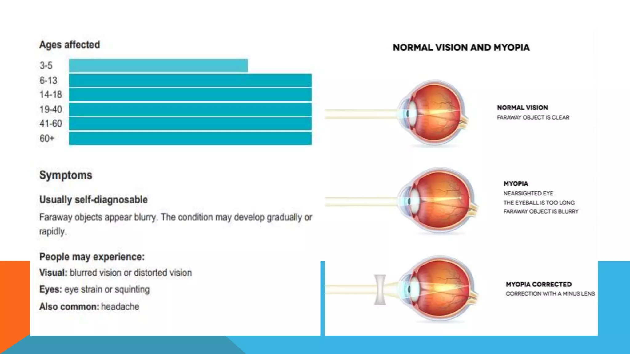 Defect of vision | PPTX