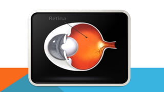 Defect of vision | PPTX