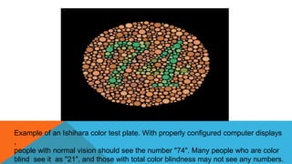 Defect of vision | PPTX