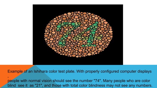 Defect of vision | PPTX