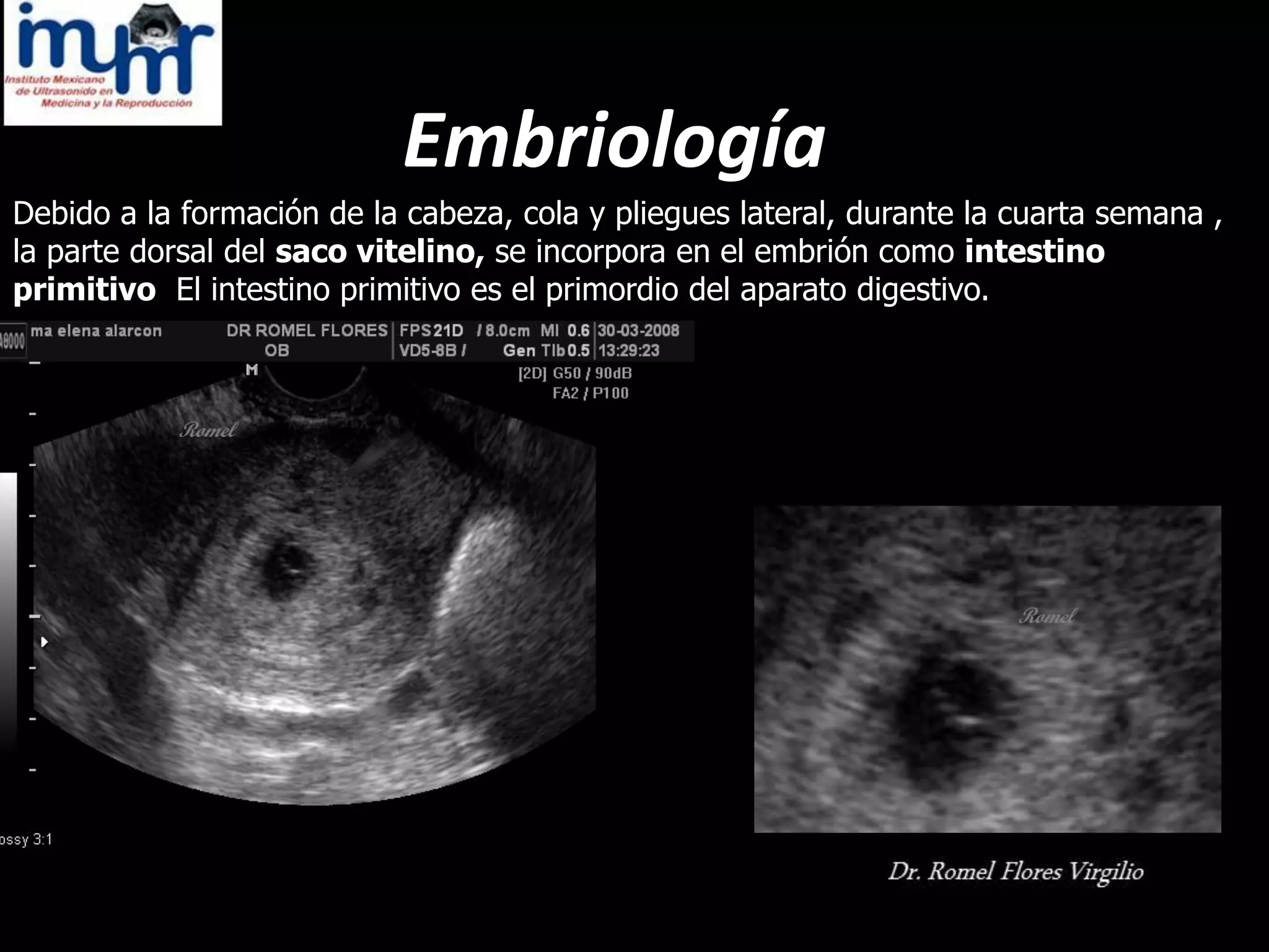 Defectos de la pared abdominal fetal.ppt para slsh | PPT