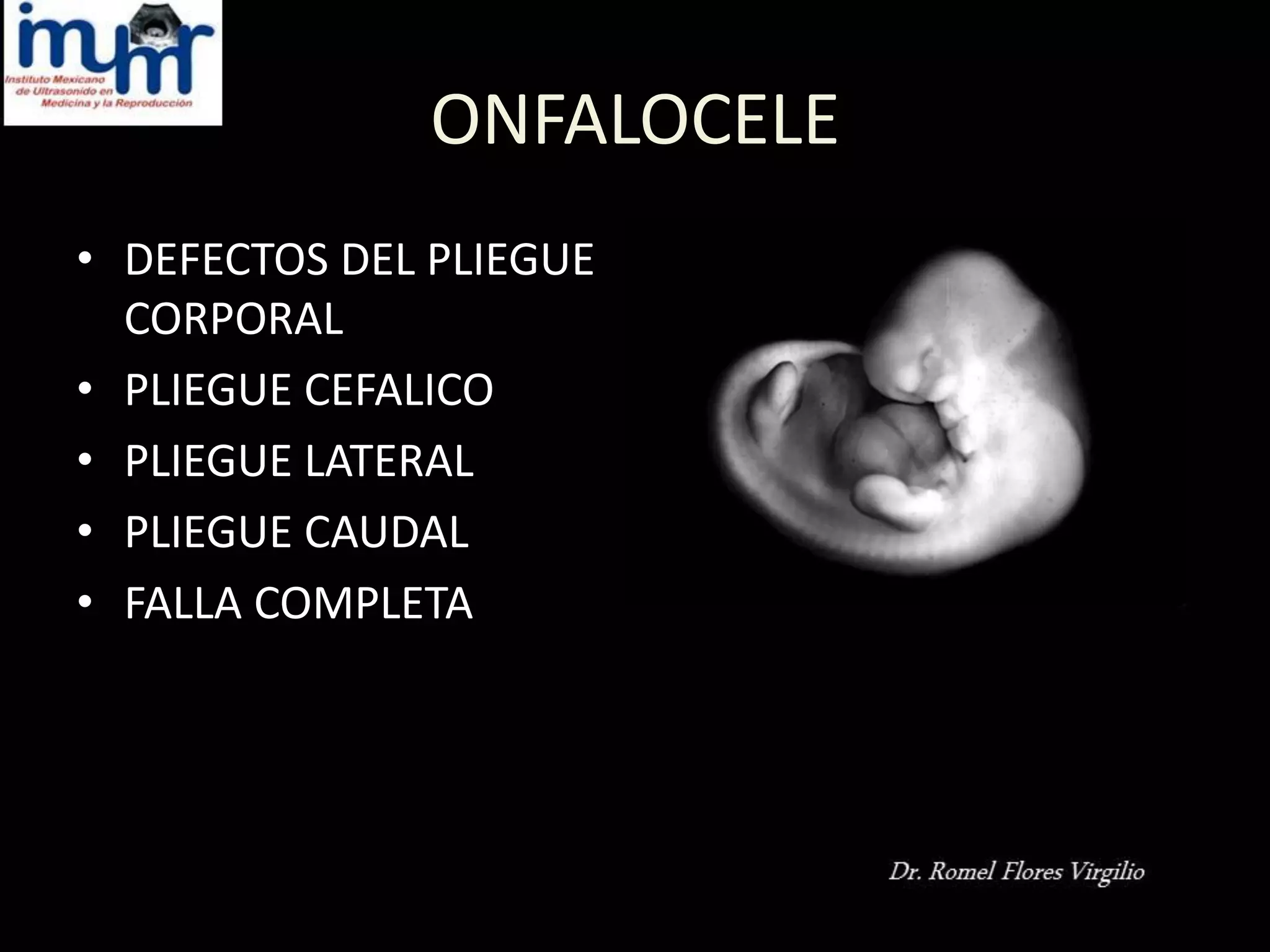 Defectos de la pared abdominal fetal.ppt para slsh | PPT