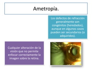 Defectos de la refracción | PPTX
