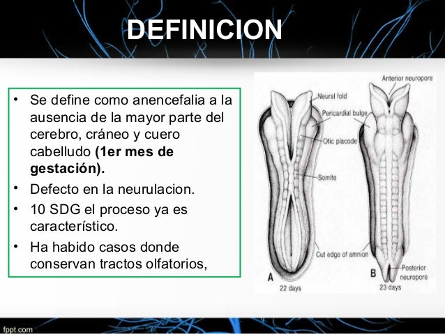 Defectos Del Tubo Neural