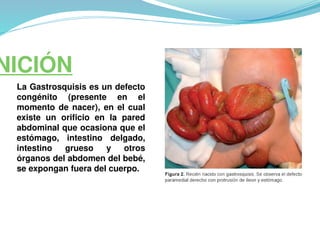 Defectos de pared abdominal.pptx Traumatismo Craneoencefalico en ...