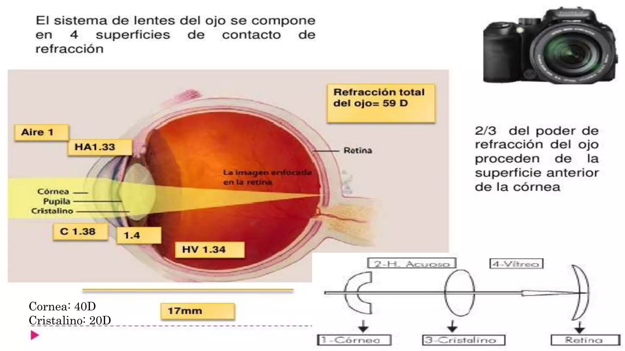 Defectos de refracción | PPTX | Eye and Vision Conditions | Diseases ...
