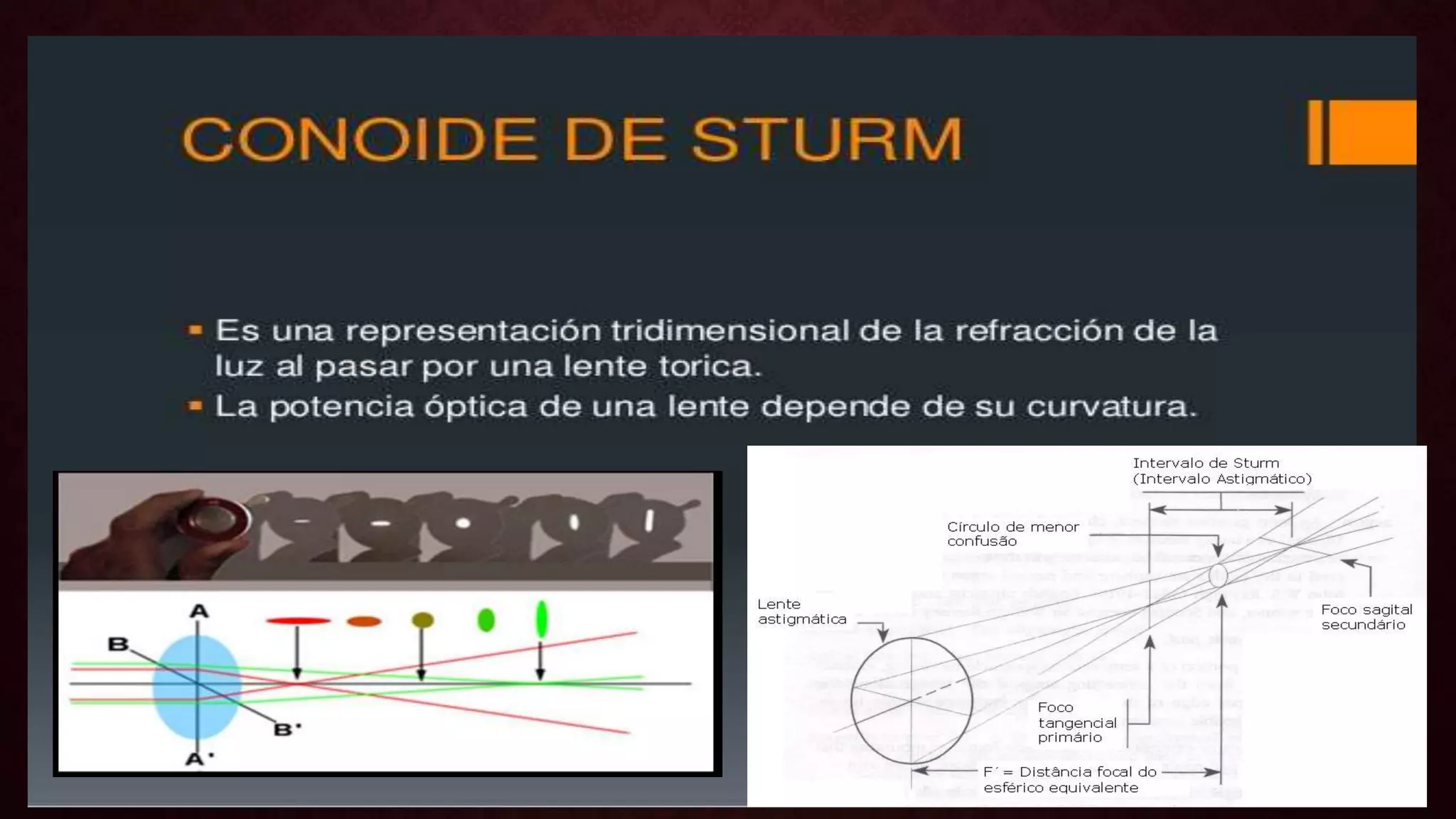 Defectos de refracción | PPTX | Eye and Vision Conditions | Diseases ...