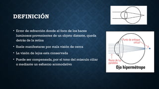 defectos de refracción (miopía, hipermetropía, astigmatismo).pptx