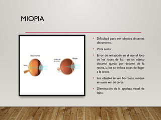 Defectos de refracción. Ofatlmologia médica | PPTX