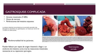 defectos de pared mas común en pediatria son la onfalocele y la ...