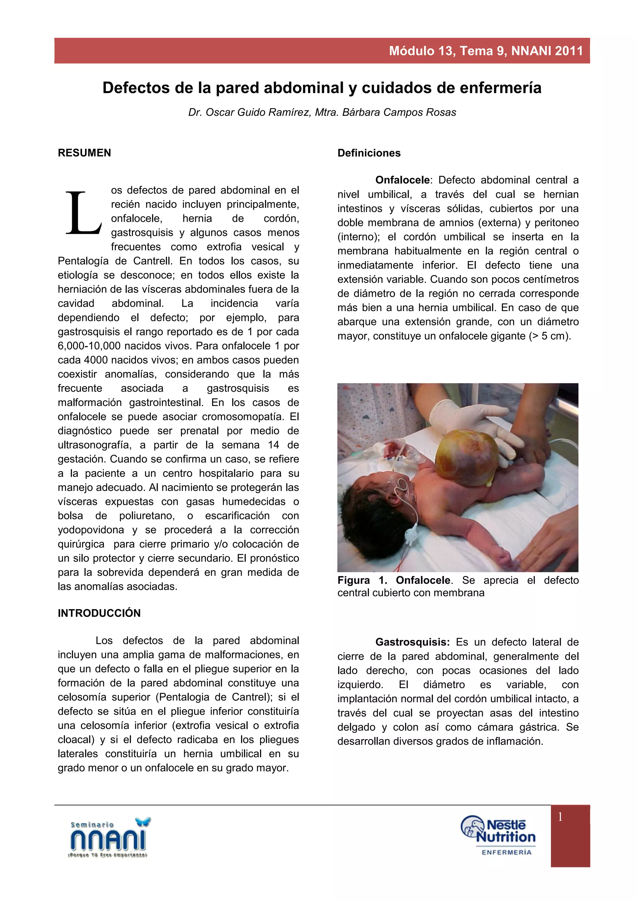 Defectos pared abdominal | PDF