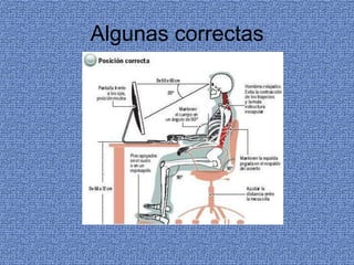Defectos posturales | PPTX