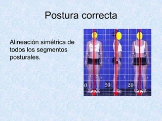 Defectos posturales | PPTX