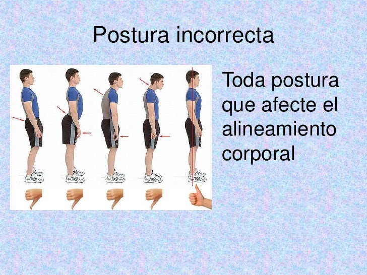 Defectos posturales