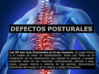 Defectos posturales | PPTX