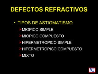 Defectos refractivos | PPTX