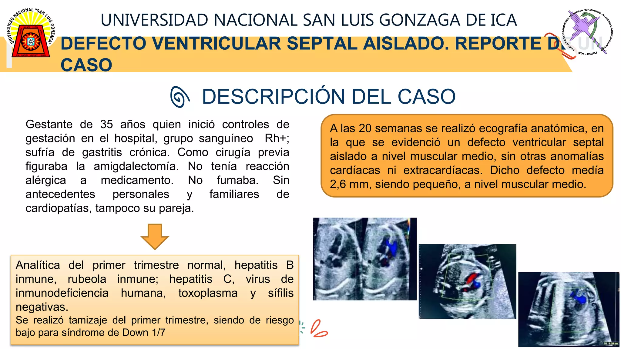 DEFECTO VENTRICULAR SEPTAL AISLADO. REPORTE DE UN CASO.pptx