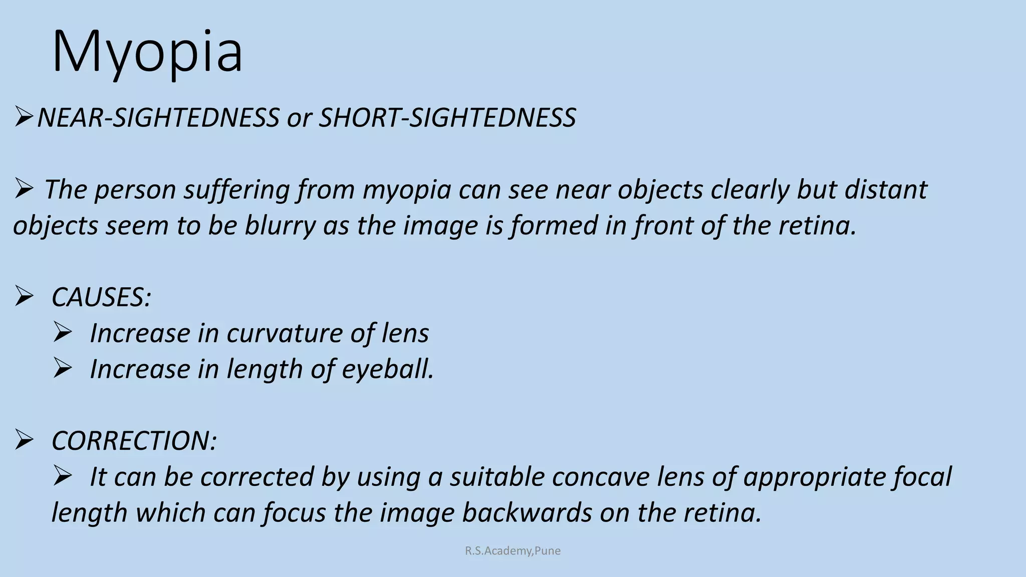 Defects of human eye | PPTX