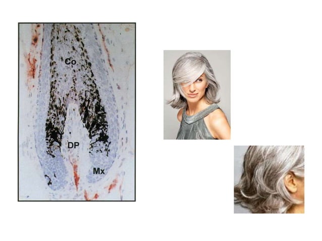 Defects of the hair shaft level 3 | PPT