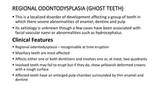Defects of tooth structure | PPTX